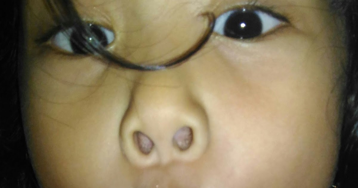 .: Blognya Z I Z I :.: Muka Monyong