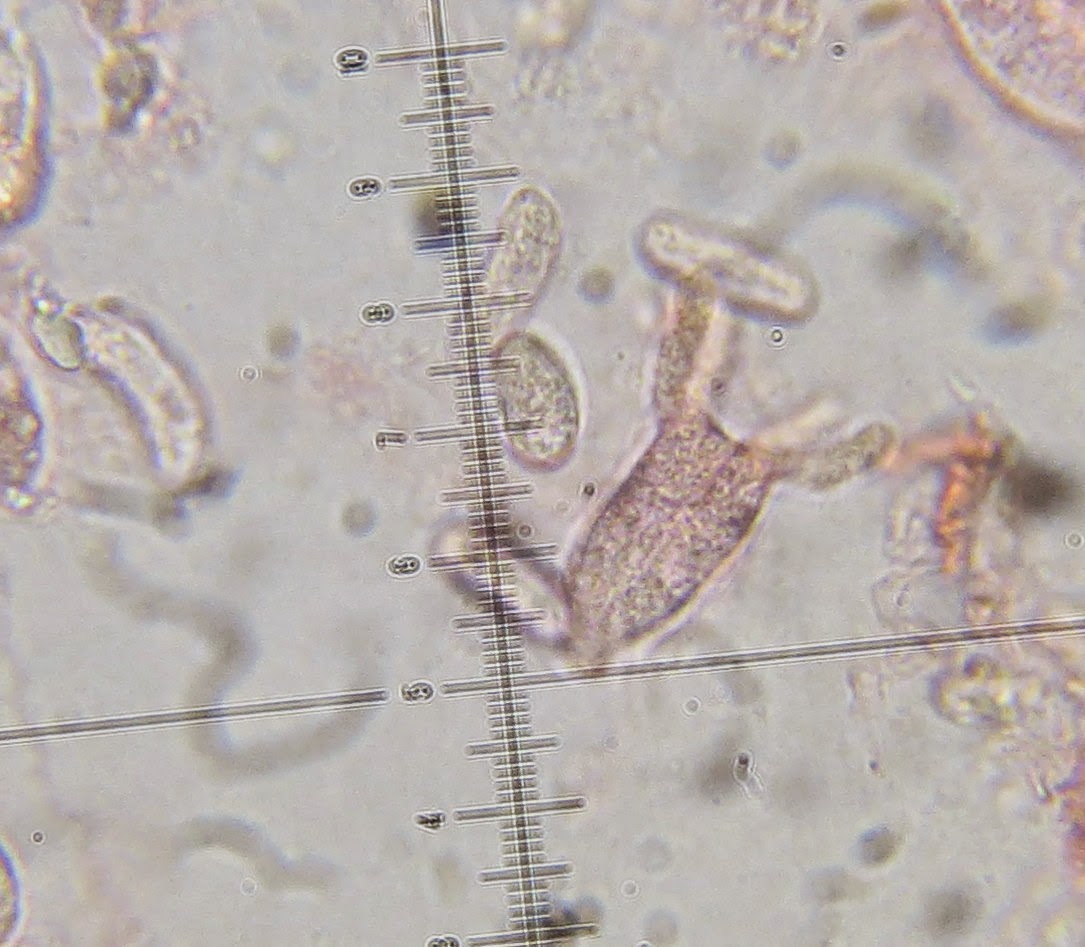 Myco Magic: Exidiopsis calcea (maybe!)