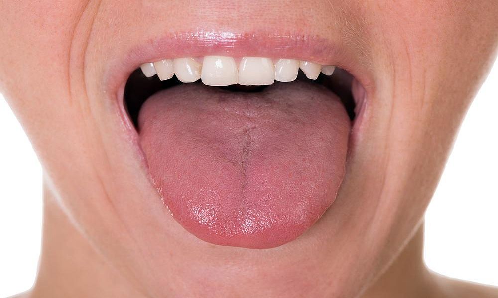 SALUD BUCAL : La importancia de la Saliva para la Salud