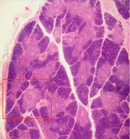 Atelier Medicina: Órganos linfáticos: Timo