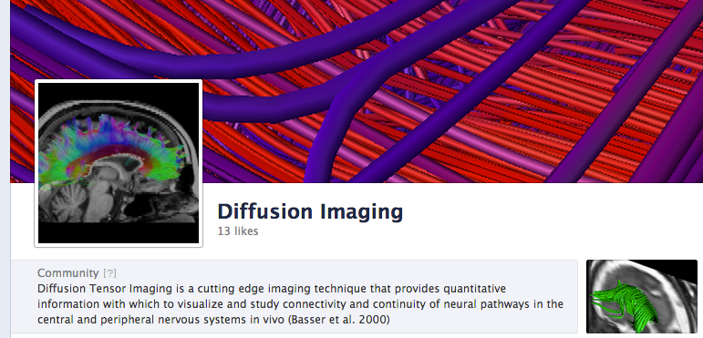 Share your diffusion imaging news | Diffusion Imaging