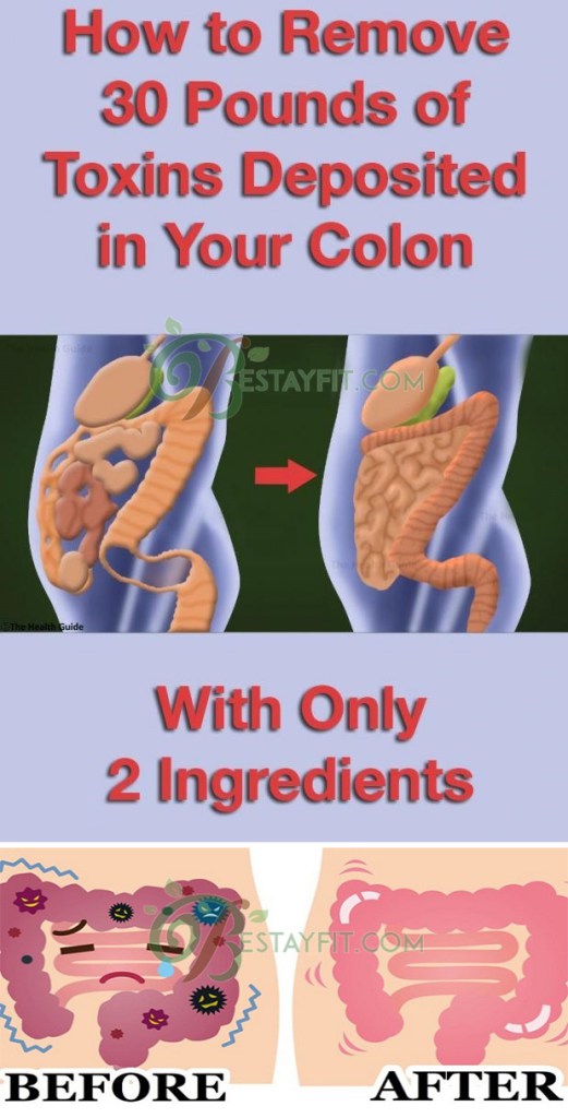 How to Remove 30 Pounds of Toxins Deposited in Your Colon with Only 2 ...