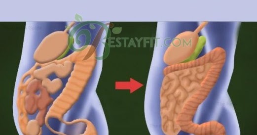 How to Remove 30 Pounds of Toxins Deposited in Your Colon with Only 2 ...