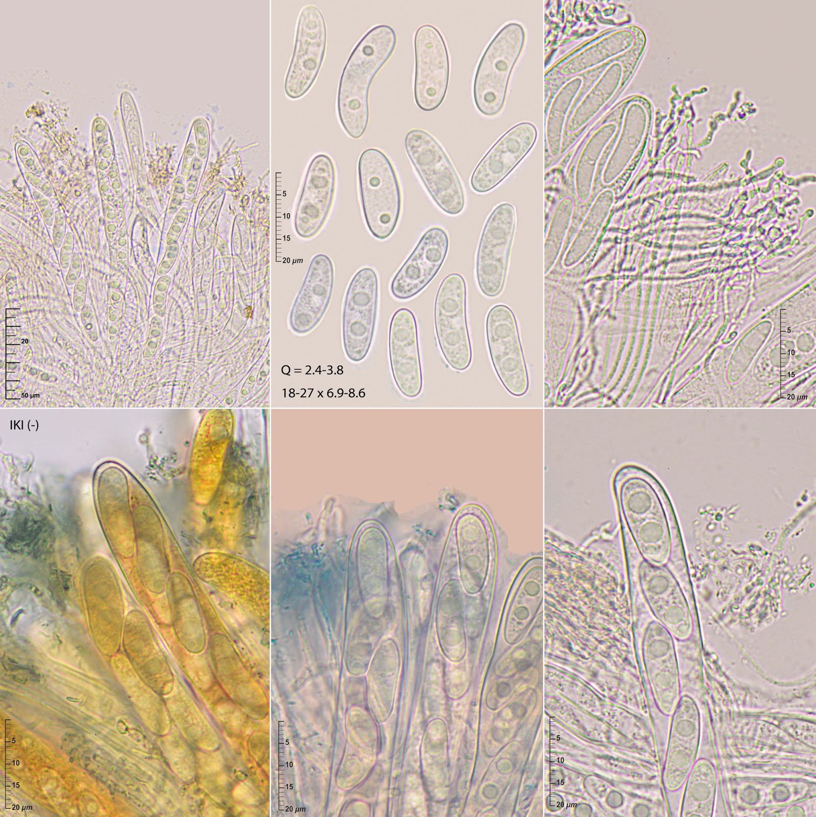 Propolis farinosa (Pers.) Fr. • CEMAS Orden Rhytismatales