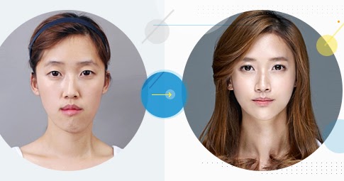 Operasi dua rahang, Apa itu?