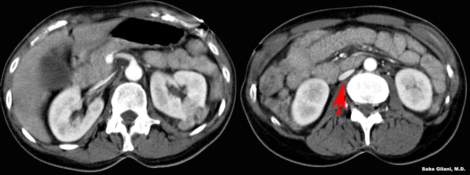 Roentgen Ray Reader: December 2012