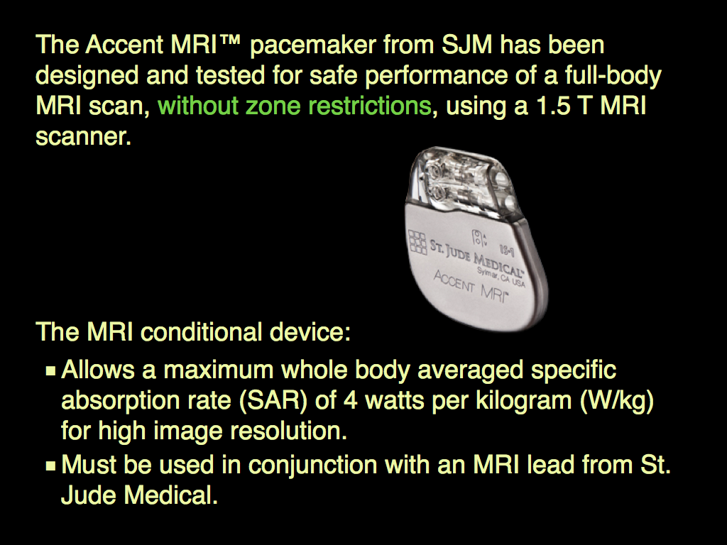 MRI BLOG: MRI-Conditional Cardiac Pacemakers & Leads from St. Jude ...