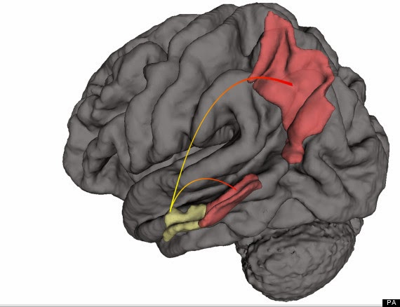 el alzheimer: Región del cerebro. Identificado Dónde comienza la ...