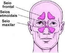 DICAS DE RADIOLOGIA - Tudo Sobre Radiologia: RAIO X SEIOS DA FACE OU ...