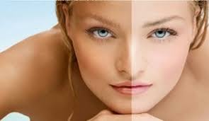 How to Cure White Spots on Skin | Natural Vitiligo Treatment