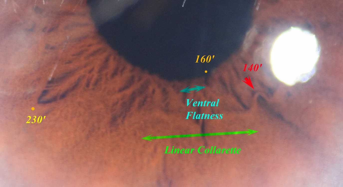 Modern & Multidimensional Iridology: The Combination & Correlation on ...