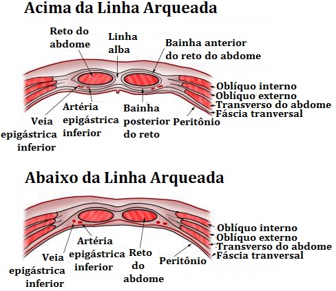Limatreinamento: Diástase do Reto Abdominal