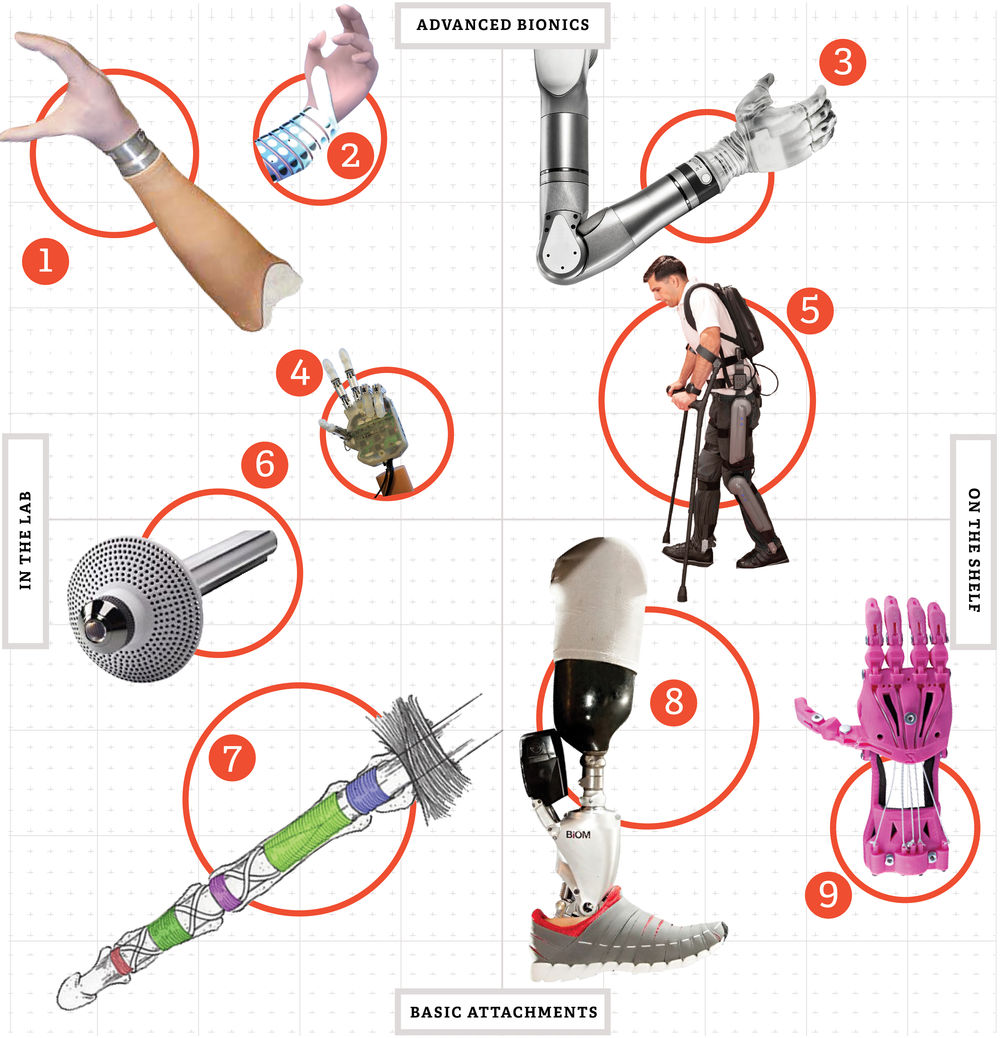 Infographic:The Bionics Revolution has Begun