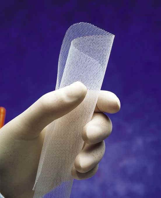 “What is mesh used in hernia surgery?”