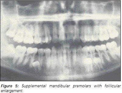 Dentistry lectures for MFDS/MJDF/NBDE/ORE: A Note On Classification ...