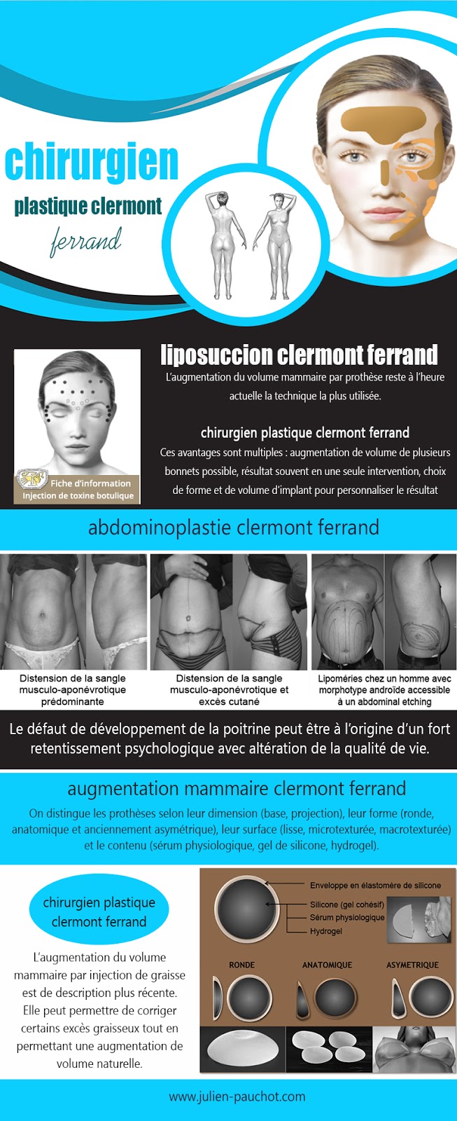 dermolipectomie: injection acide hyaluronique clermont ferrand