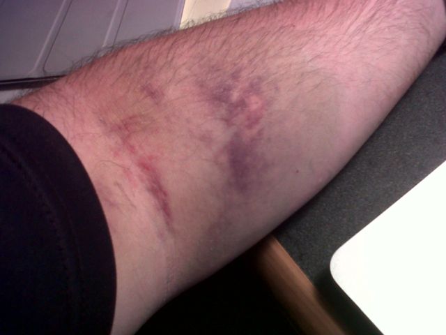 Talentd Mr Ripley: Rashful Reminder