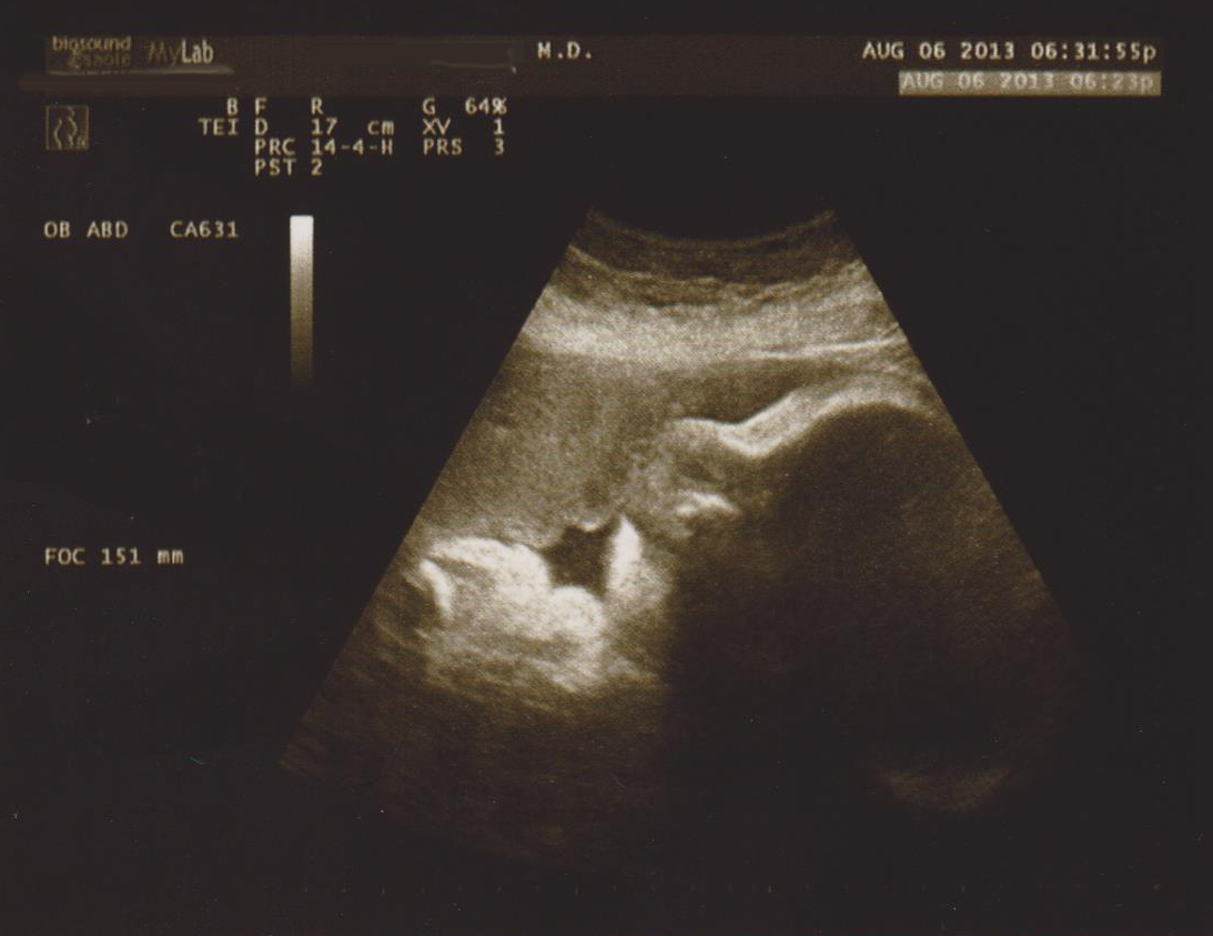 Oma Loves U!: Reef's Sonogram