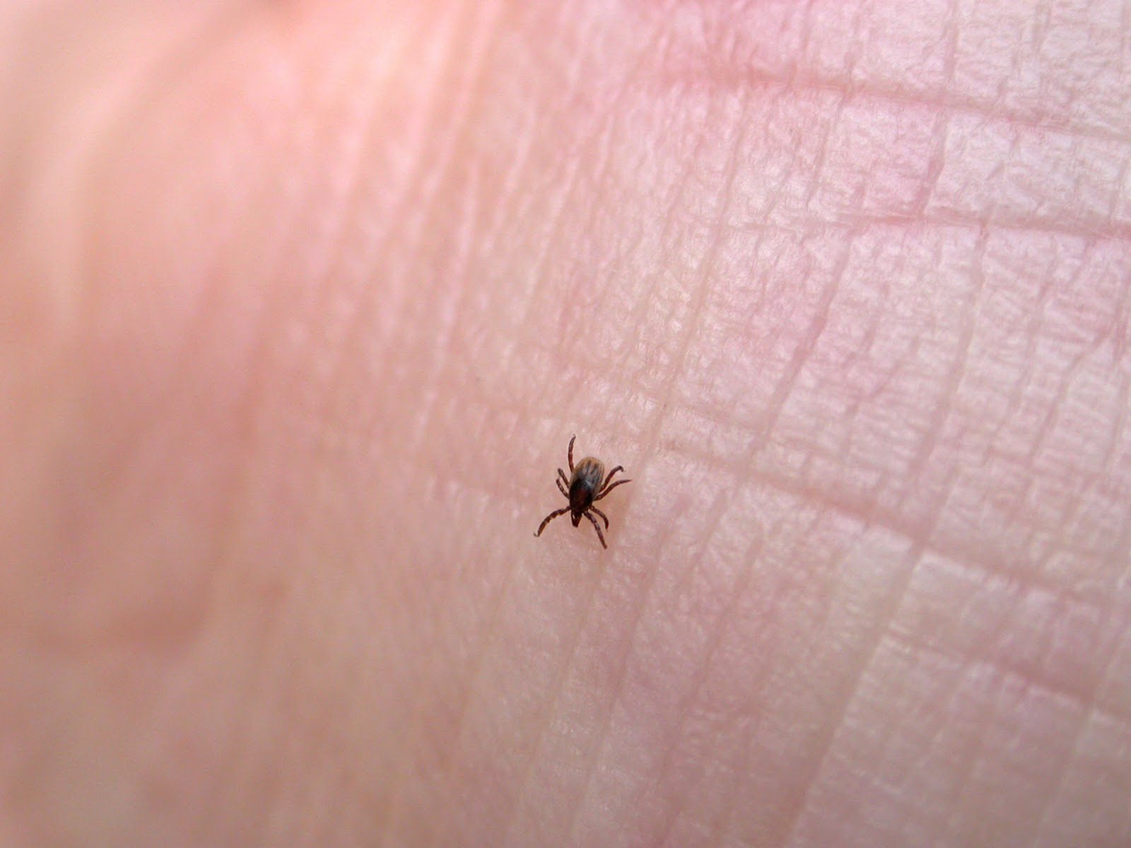 Tick Prevention & Lyme Disease