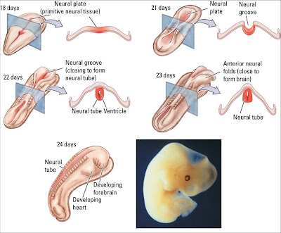 Life After Being A Student - My Mission To Learn: Neurodevelopment ...