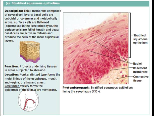Medical Information and Presentation PPT: Epithelial Metaplasia of the ...