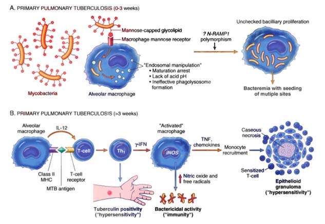Tuberkulosis (TBC): Penyebab, Gejala Dan Pengobatannya - Pengertian ...