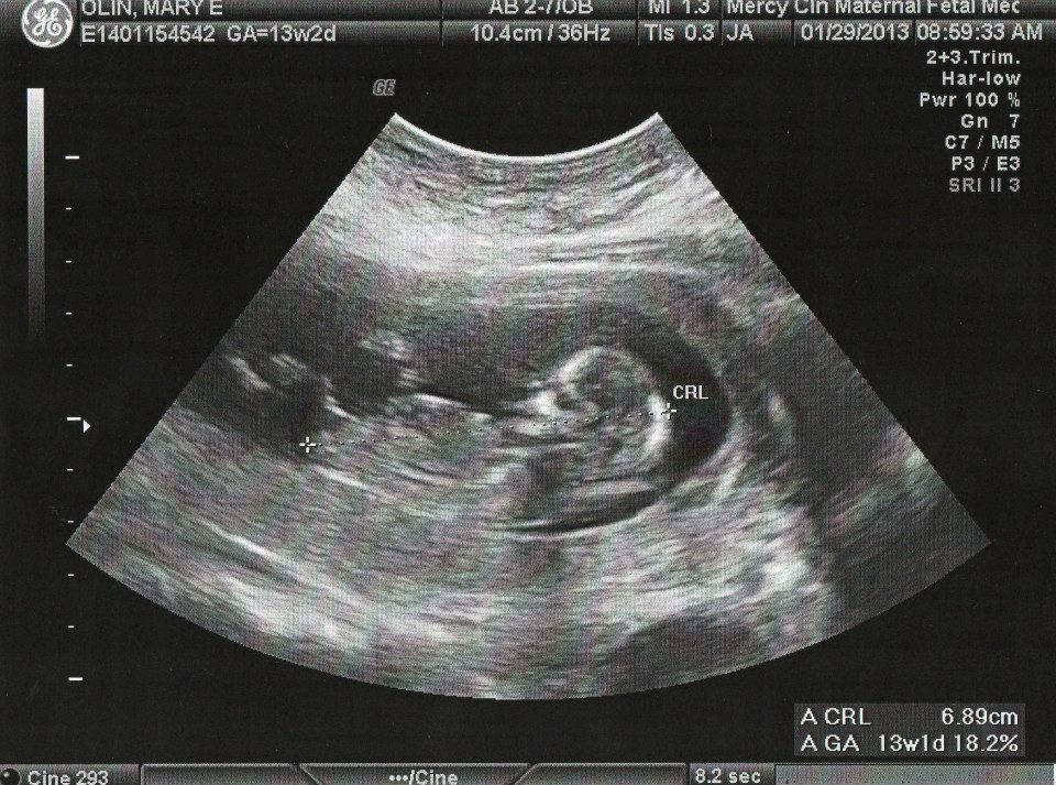 Life is Serious Business: 13 weeks -- Welcome to 2nd Trimester!!