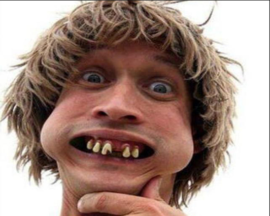 Los FEOS Se recuerdan mas facil que los atractivos