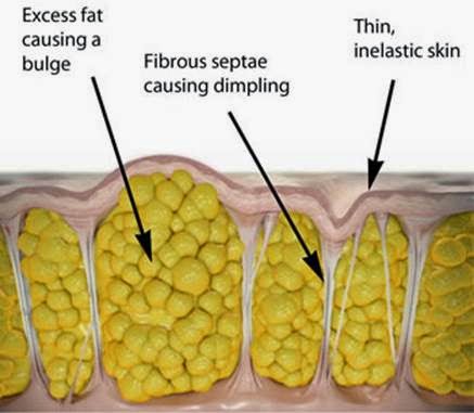 The Dermatology, Laser & Vein Center: February 2015