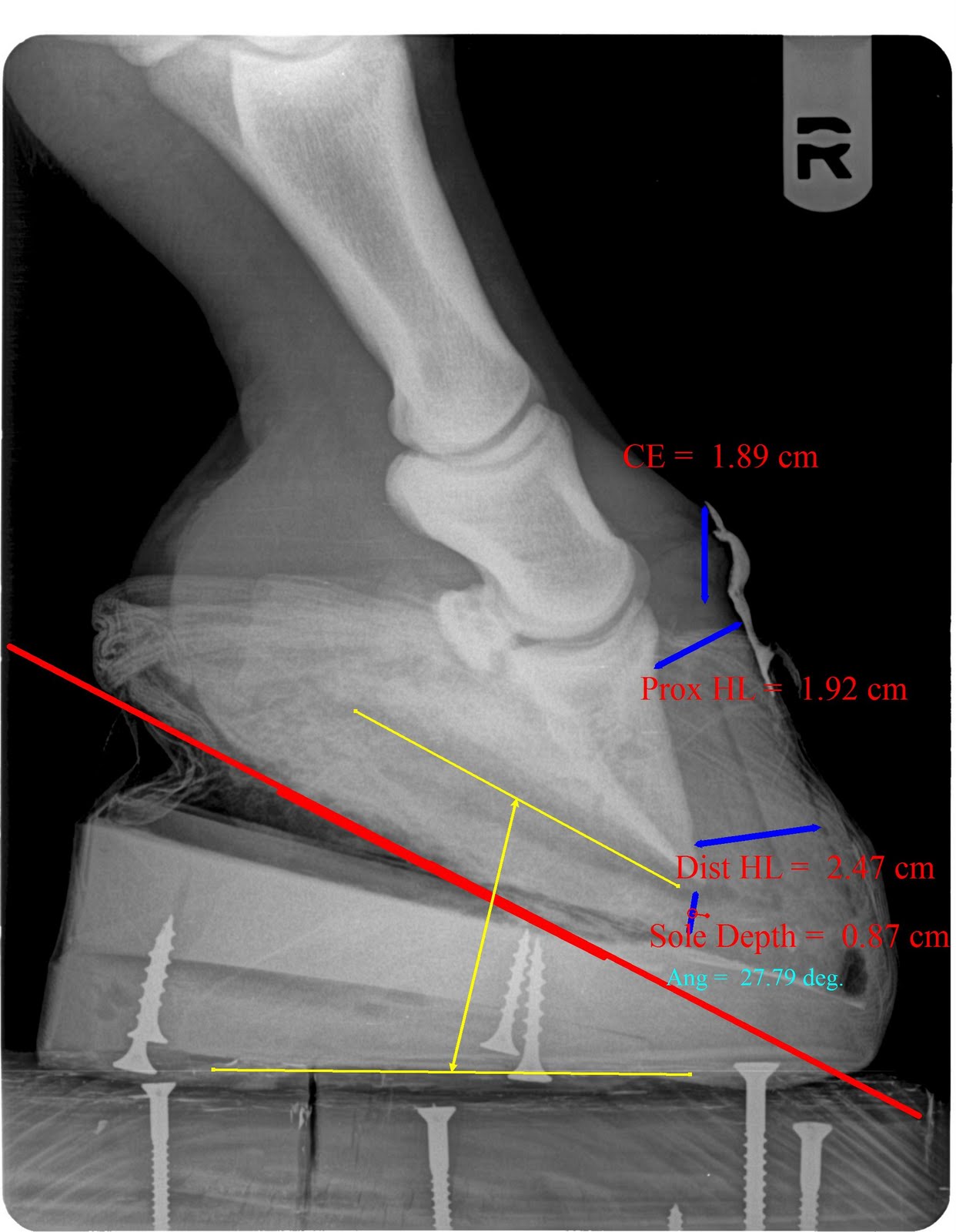 Innovative Equine Podiatry: Acute laminitis case study