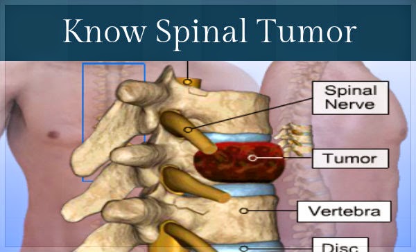 All about Orthopedics : Diseases, Conditions and Treatments: 2014