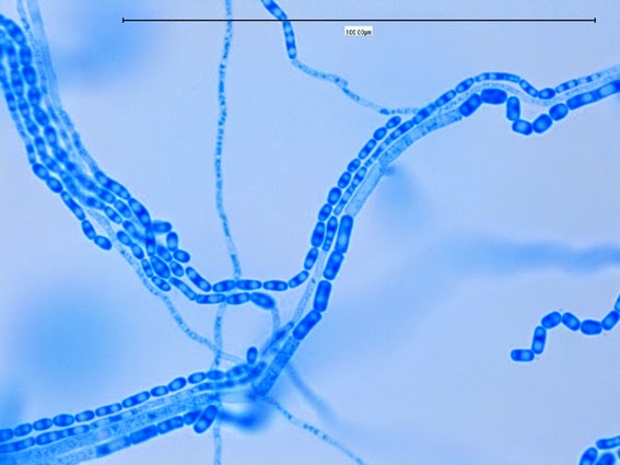 Fun With Microbiology (What's Buggin' You?): Trichosporon species