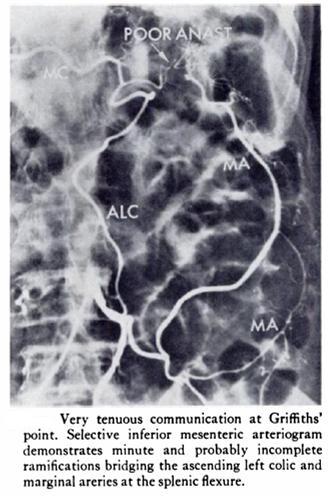 The Pump and the Tubes: Griffith's Point