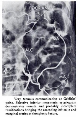 The Pump and the Tubes: Griffith's Point