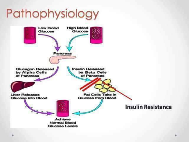 Diabetes mellitus in Pregnancy - Gestational diabetes mellitus, effect ...