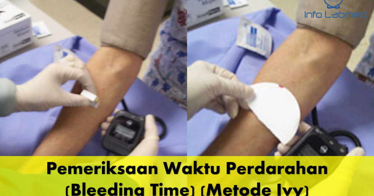Pemeriksaan Waktu Perdarahan (Bleeding Time) (Metode Ivy)