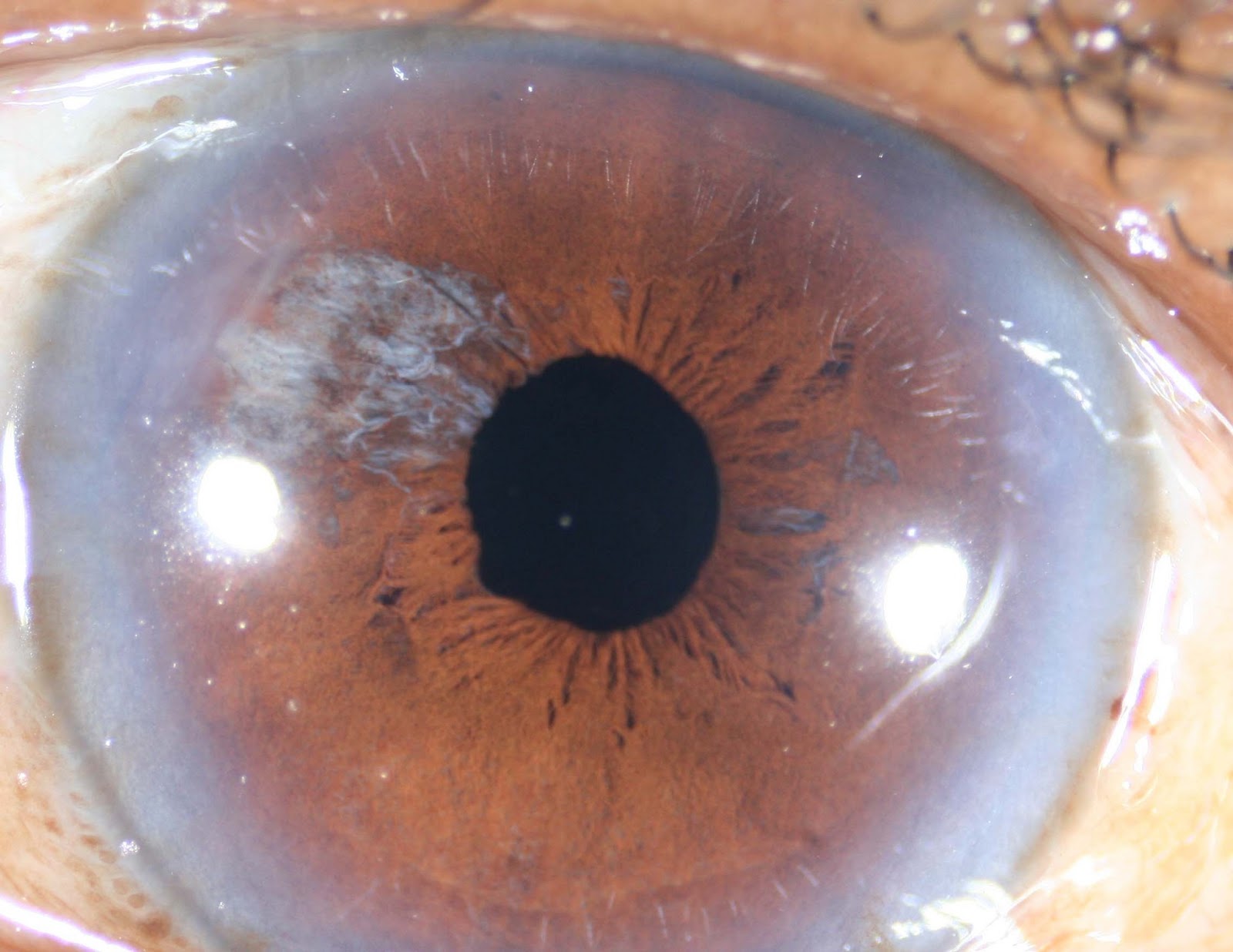 Modern & Multidimensional Iridology: The Correlation Signs in Cellular ...