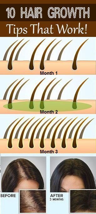 10 Best Hair Growth Tips - HEALTH CAPLET