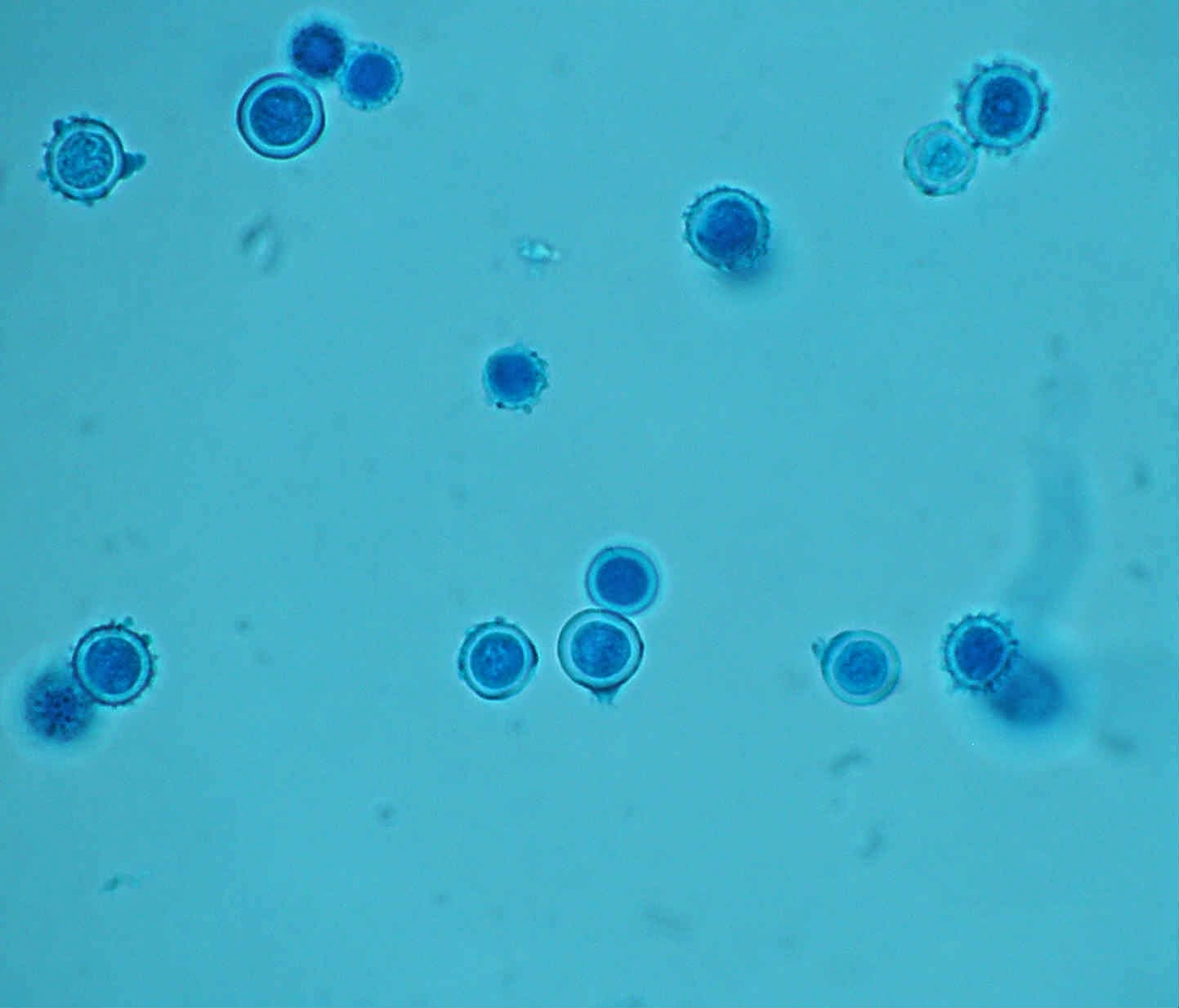 ATLAS MICOLOGIA: CONIDIOBOLUS CORONATUS