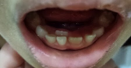 ~Mamamie's Thots~ Singapore Parenting and Lifestyle Blog: The Stubborn ...