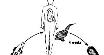 Public Health Resources: Capillariasis | Philippine Health Advisory