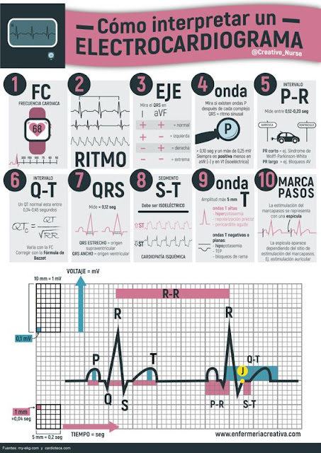 Sapientia Aeternam: EKG interpretación
