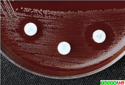 [Microbiology] Atlas of Anaerobes of Clinical Importance | Free Medical ...