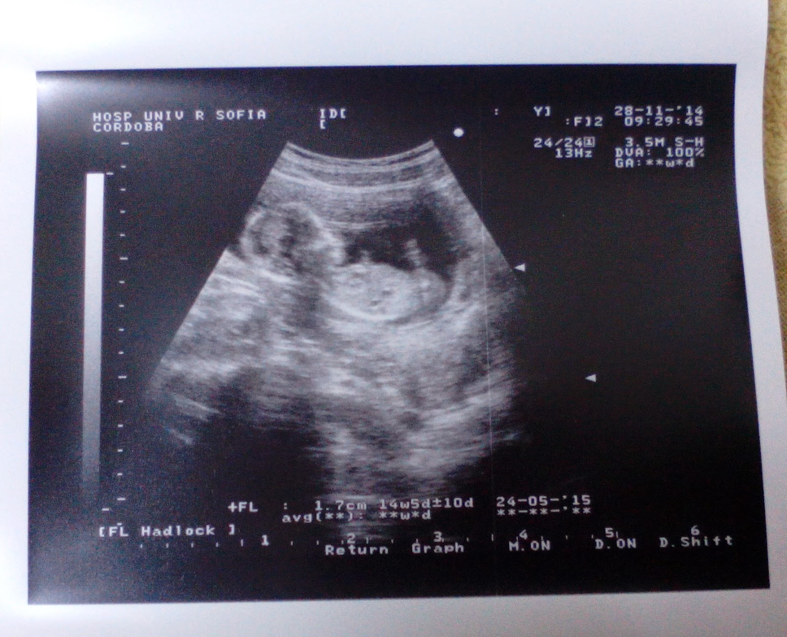 Maternidad. Antes, durante y después: Ecografia 15 semanas, primera ...