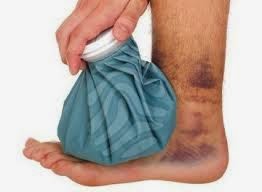 Actuación ante contusiones - Seguridad y Salud en el Trabajo