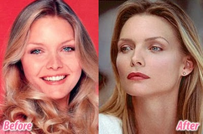 Michelle Pfeiffer Plastic Surgery Nose Job, Facelift, Botox Injections ...