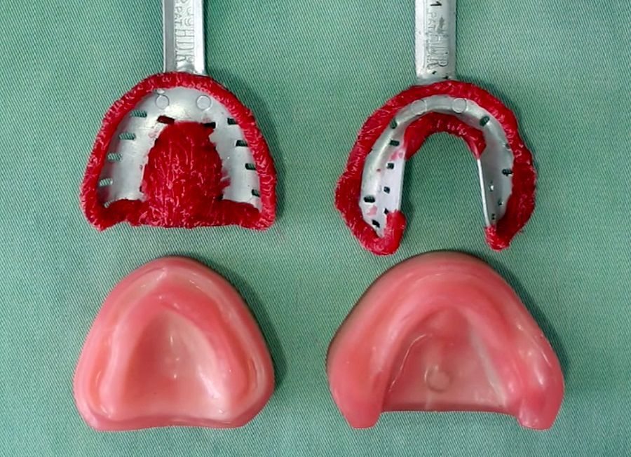 PRÓTESE TOTAL: Aula de Moldagem Anatômica e confecção de modelo de ...