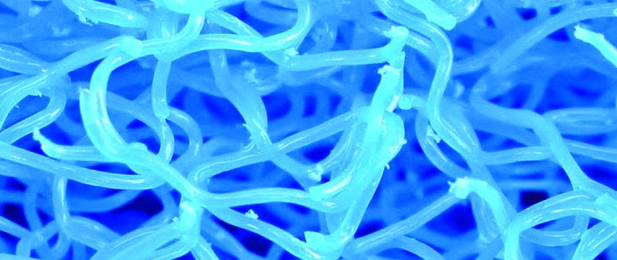 Ganggang Biru (Cyanophyta) ~ Handes Scream