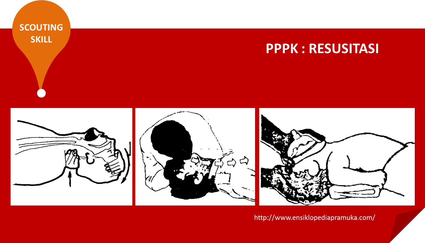 PPPK : Resusitasi