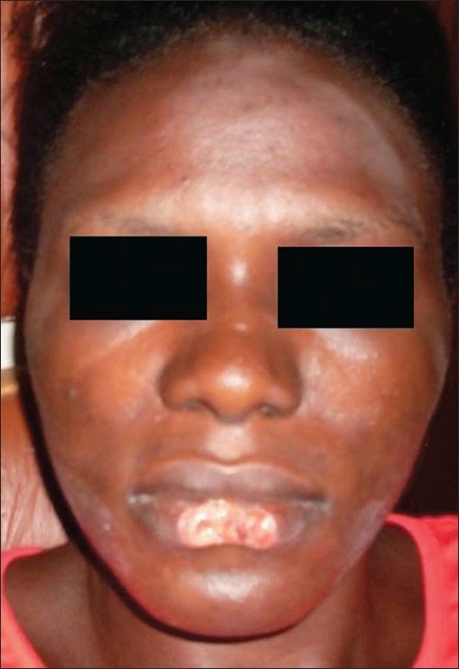 me, my pen and I: Bizman accused of biting off woman’s lip